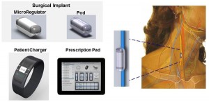 SetPoint Medical – The World of Implantable Devices