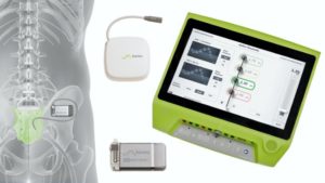 Axonics’ r-SNM Implantable Sacral Neurostimulator for Urinary and Bowel ...