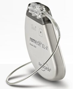 Sleep Apnea – The World of Implantable Devices