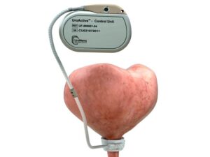 The World of Implantable Devices – Page 2 – A blog about what is new ...