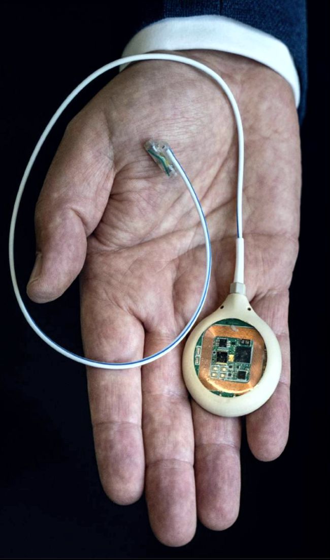 The World of Implantable Devices – A blog about what is new (and old ...